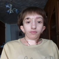 Maria Munteanu solicită donații pentru aparat de oxigen